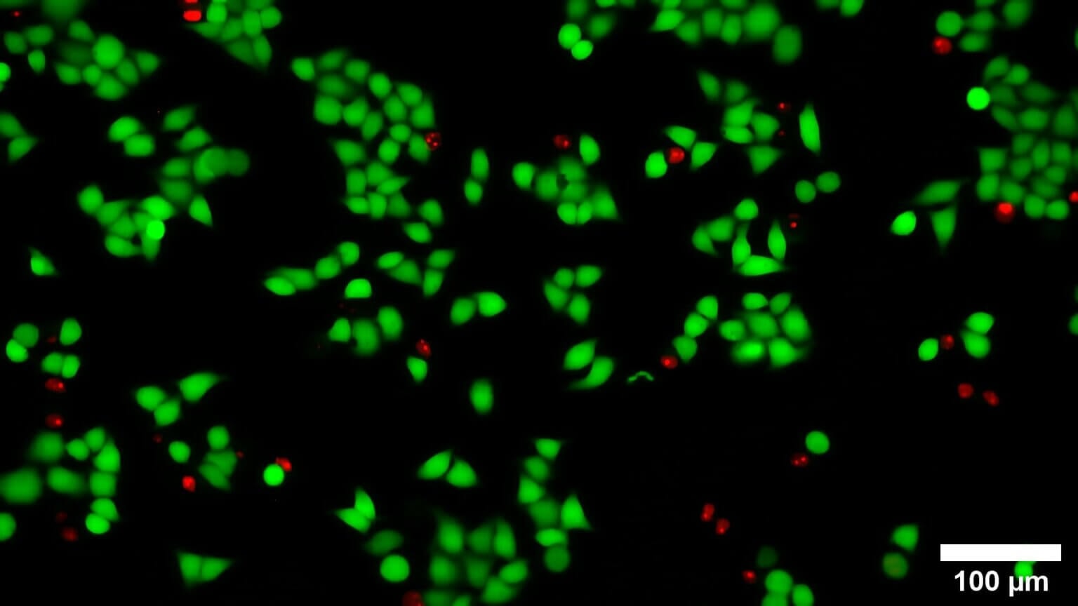 How to stain cells cultured in a microfluidic chip? - Elveflow