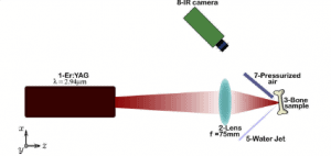 Optimizing deep bone ablation using an automated system - Elveflow