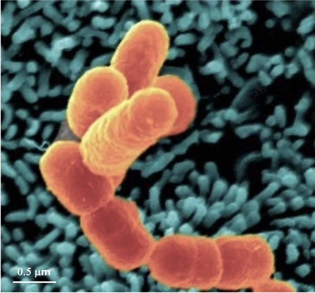Using Gut-on-a-chip and imaging to understand pathogen invasion